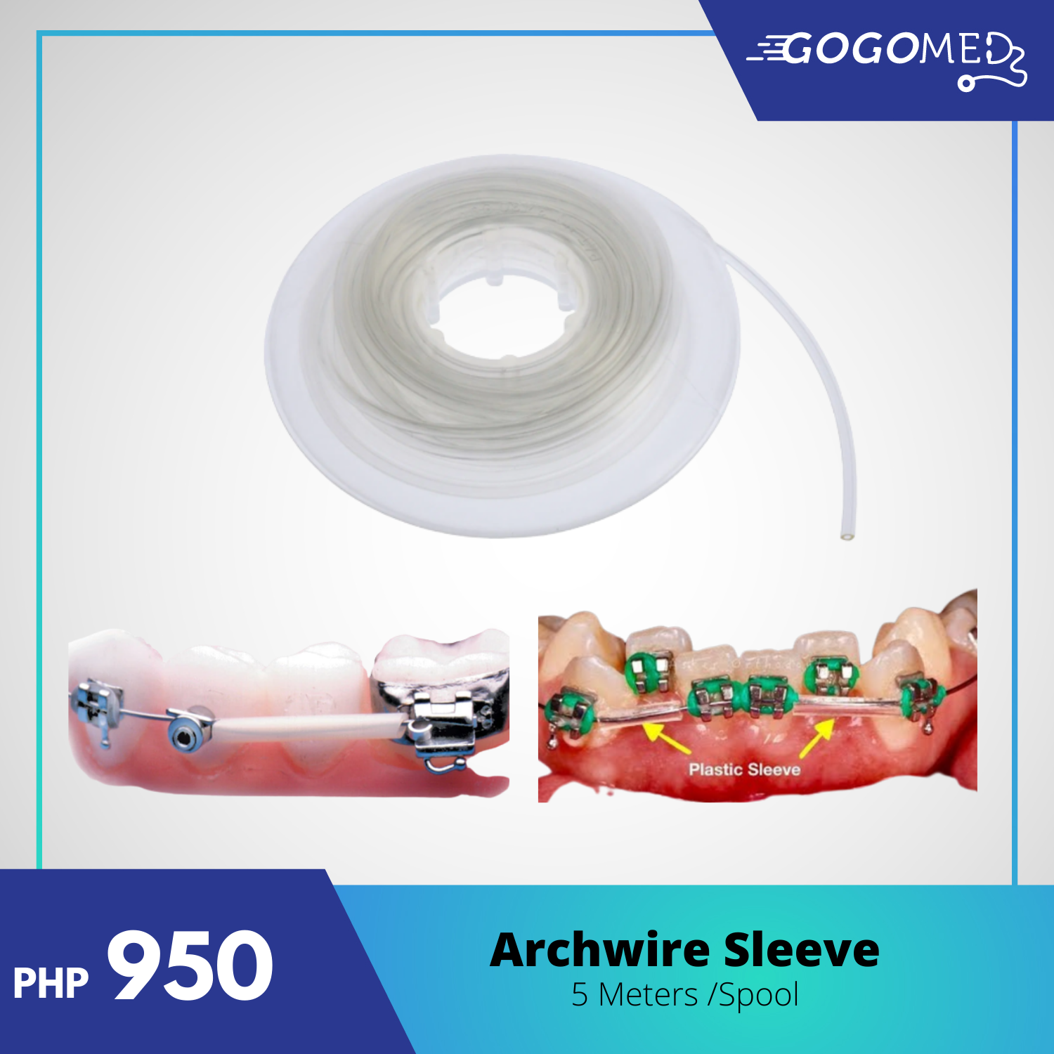 Archwire Sleeve/Tissue Guard 5 Meters - DTC USA – Gogomed Supplies