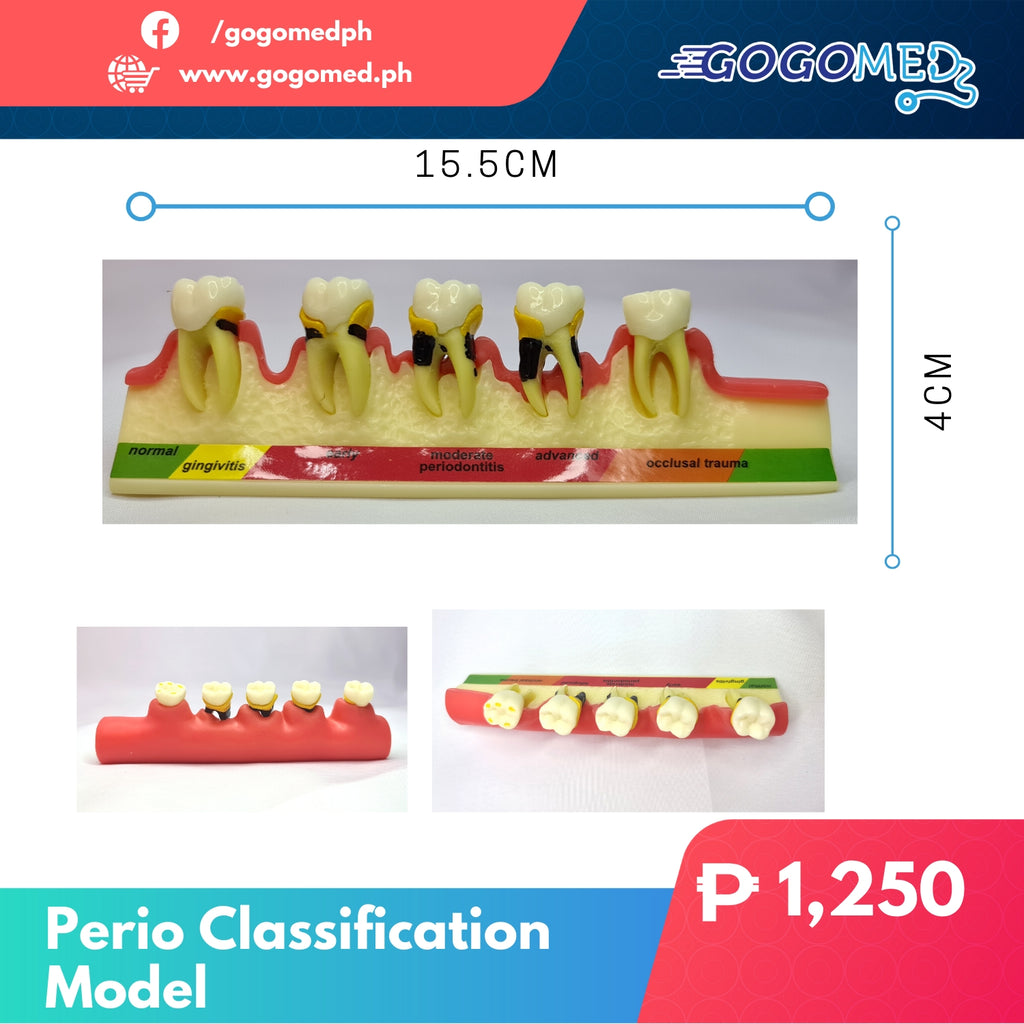 Perio Classification Model – Gogomed Supplies